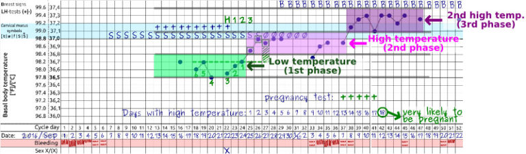 Triphasic Chart as a Sign of Pregnancy?